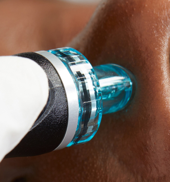 Treatments - Hydrafacial