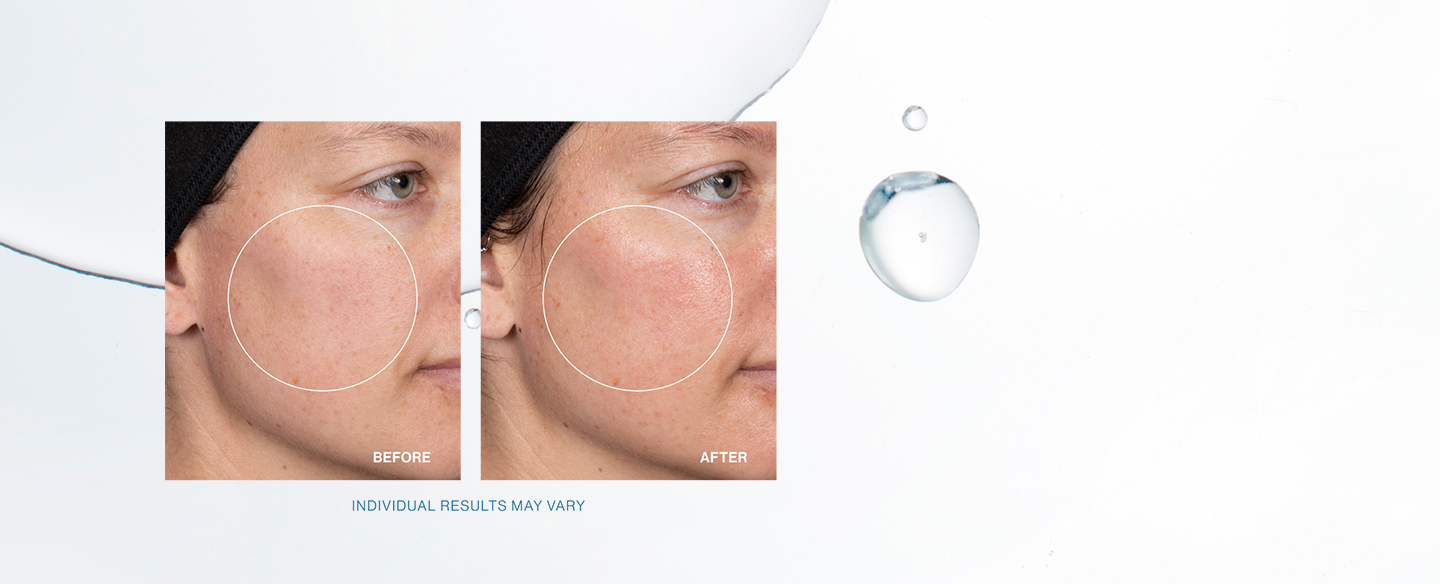 Hydralock HA Booster B2B - Hydrafacial